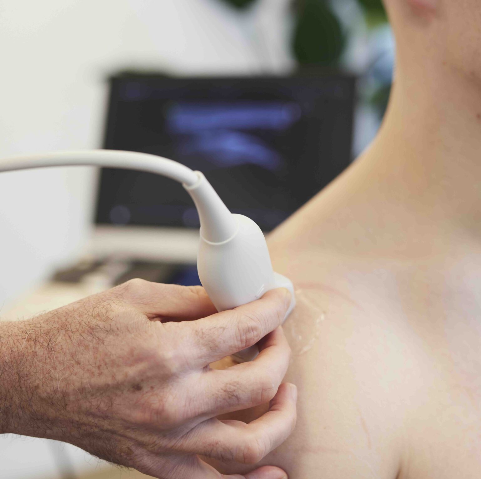 Spierscheur: Oorzaken, Symptomen & Behandeling | Spine Clinics